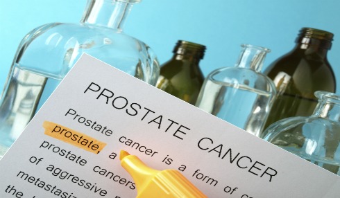 Prostate Cancer | When To Be Concerned And What You Should Know?